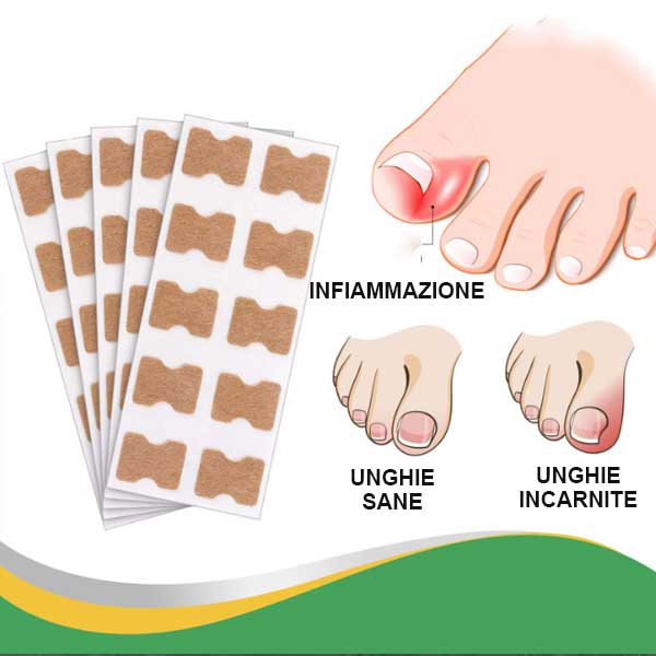 Liberati dalle unghie incarnite!